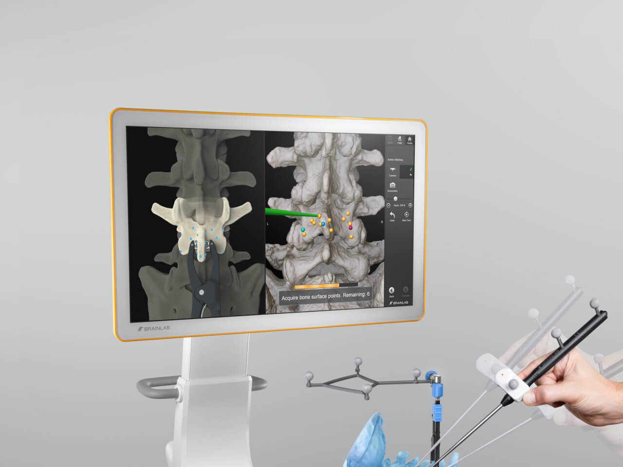 Image Registration: Imaging Solution for Spine Surgeries | Brainlab
